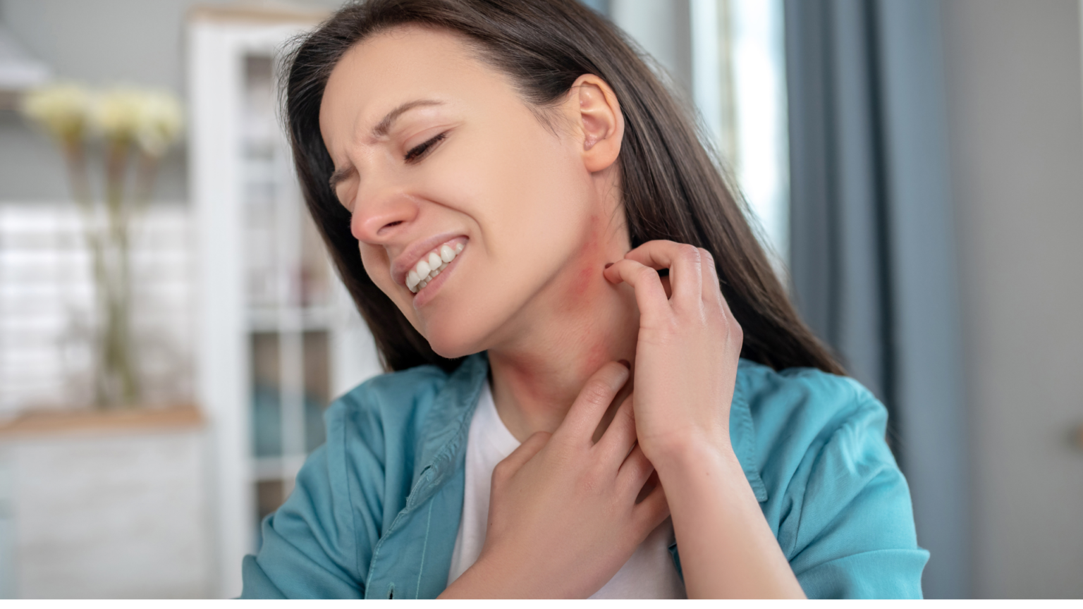 6 Enfermedades que Pueden Causar Picazón en la Piel